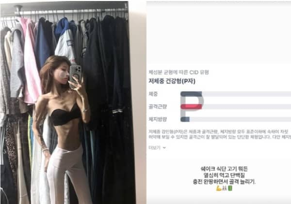 96kg→41kg 감량 성공? 뼈 모양까지 보일정도로 드러난 팔